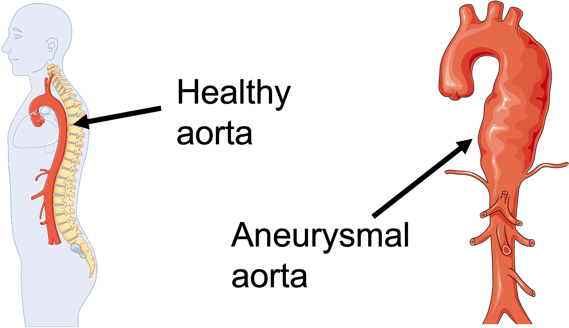 Automatically Quantifying Aortic Growth in Diverse 3D Medical Images | Timothy James Baker